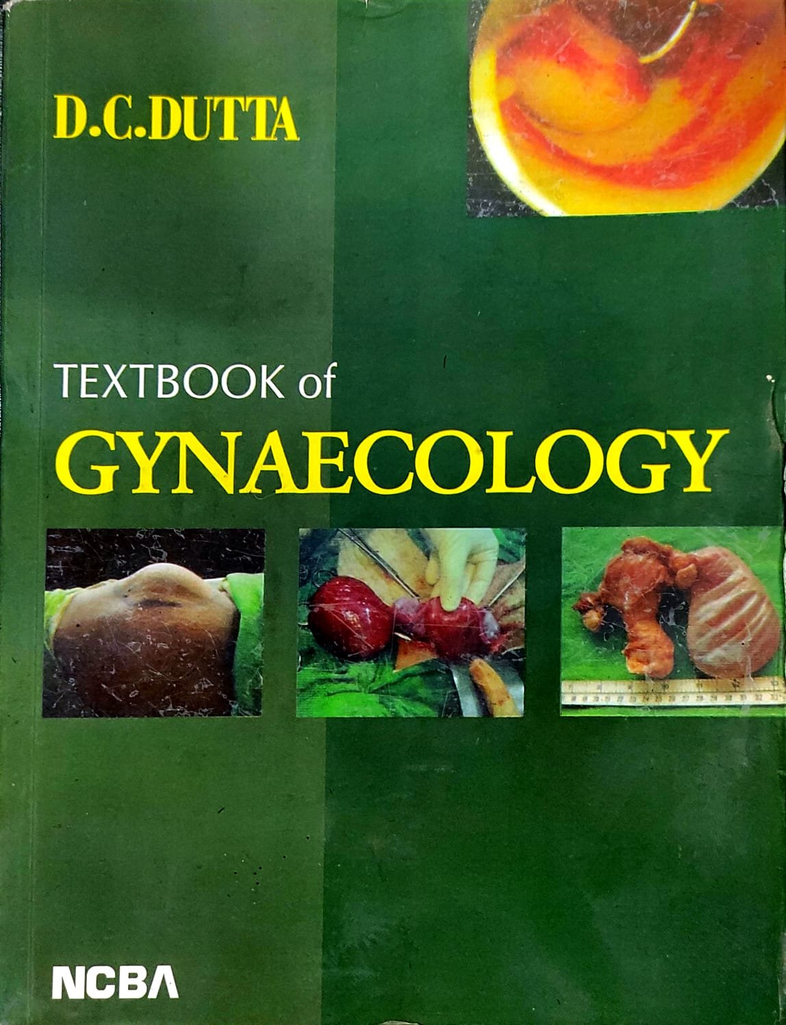 Second Hand Texbook Of Gynaecology | DC Dutta 5th Edition » WishAllBook ...