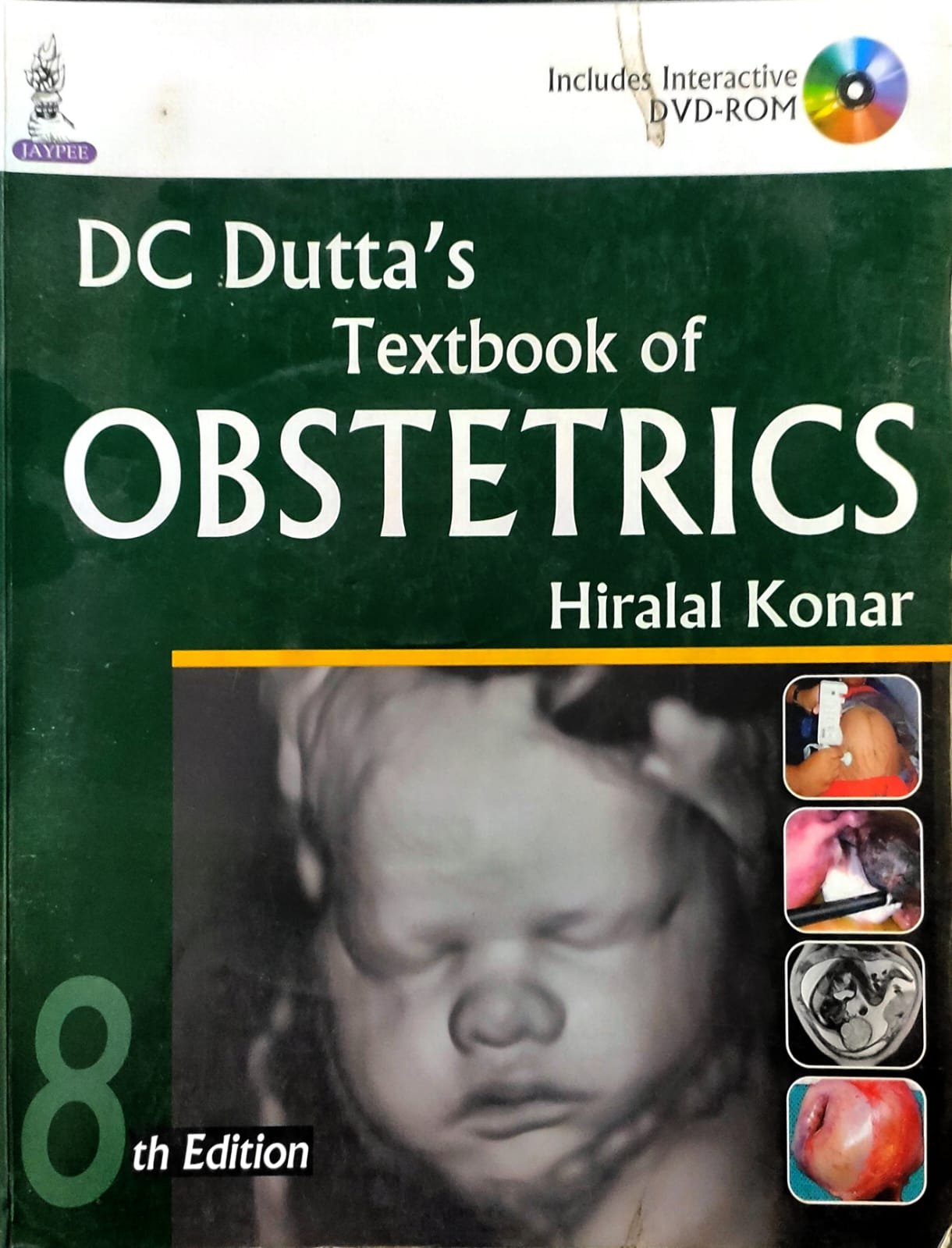Second Hand DC Dutta Textbook Of Obstetrics By Hiralal Konar 8th Edition » WishAllBook | Online ...